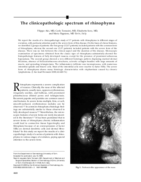 (PDF) The clinicopathologic spectrum of rhinophyma