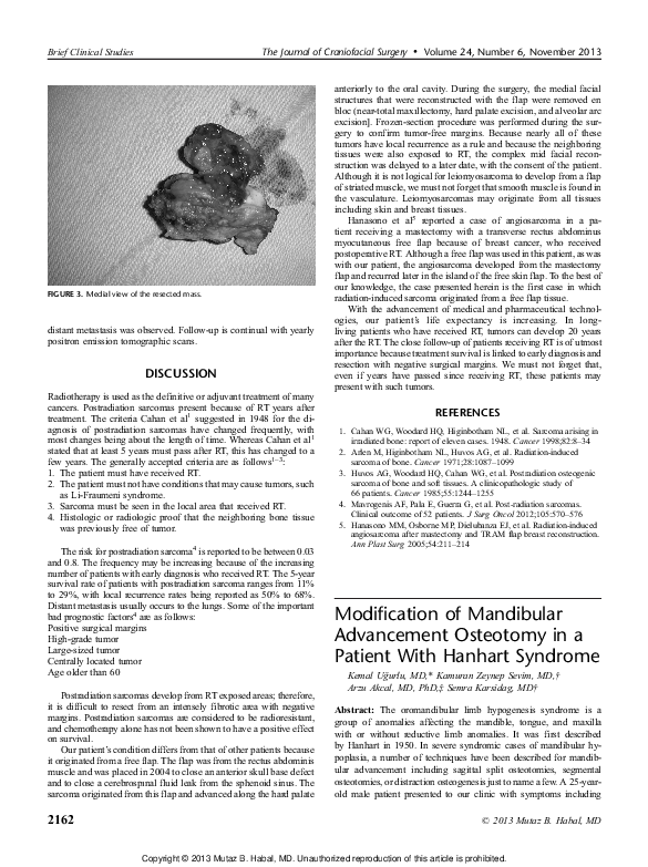 (PDF) Modification of Mandibular Advancement Osteotomy in a Patient ...