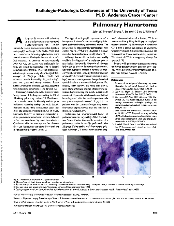 (PDF) Giant pulmonary hamartoma | Henrique Lederman - Academia.edu