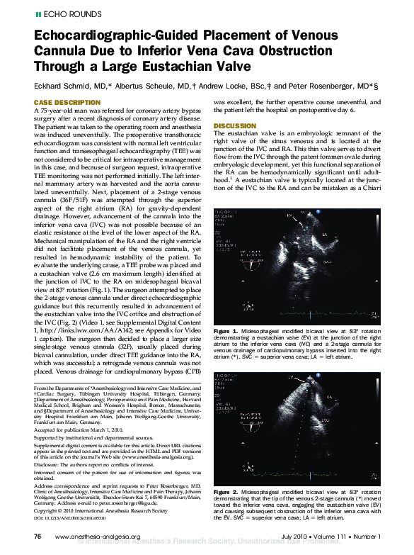 (PDF) Echocardiographic-Guided Placement of Venous Cannula Due to ...