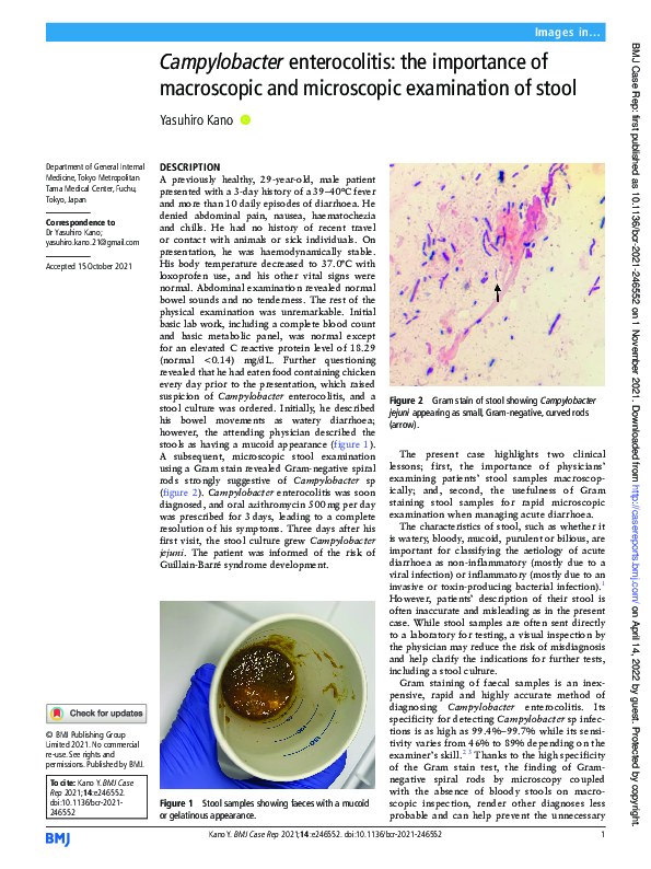 (PDF) Campylobacter enterocolitis: the importance of macroscopic and ...
