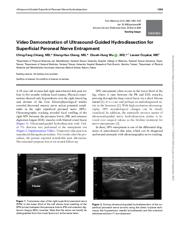(PDF) Video Demonstration of Ultrasound-Guided Hydrodissection for ...