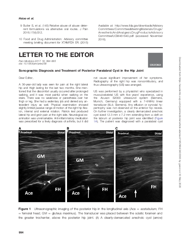 (PDF) Sonographic Diagnosis and Treatment of Posterior Paralabral Cyst ...