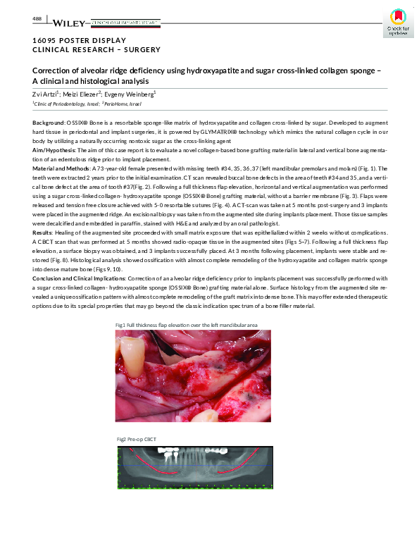 (PDF) Correction of alveolar ridge deficiency using hydroxyapatite and ...