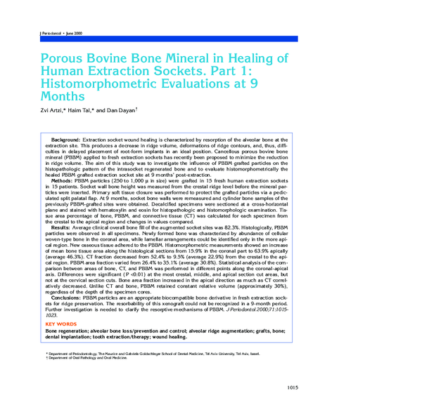 (PDF) Porous Bovine Bone Mineral in Healing of Human Extraction Sockets ...
