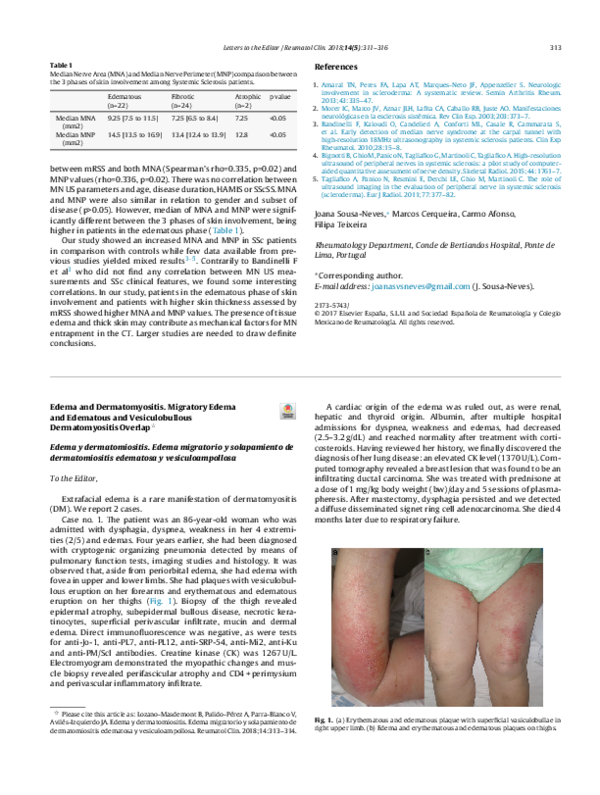 (PDF) Edema and Dermatomyositis. Migratory Edema and Edematous and ...