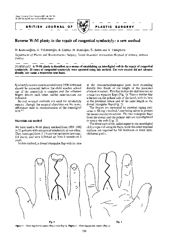 (PDF) Reverse W-M plasty in the repair of congenital syndactyly: a new ...