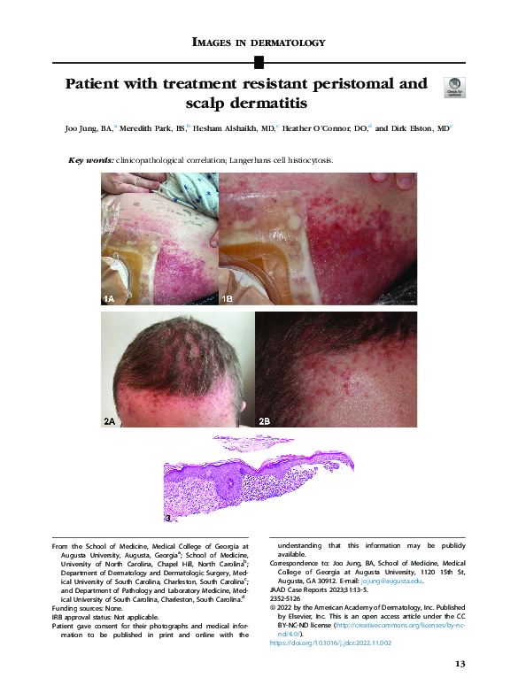(PDF) Patient with treatment resistant peristomal and scalp dermatitis ...
