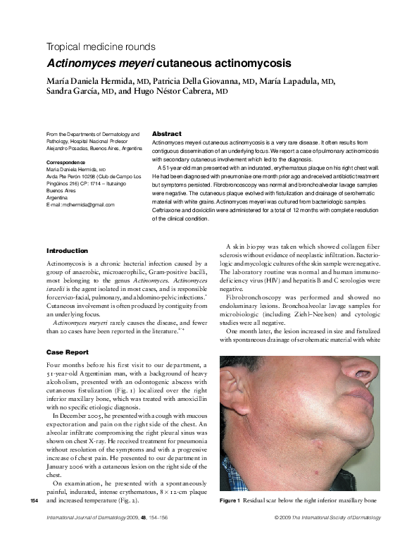 (PDF) Actinomyces meyeri cutaneous actinomycosis
