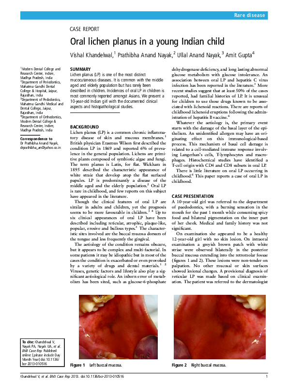 (PDF) Oral lichen planus in a young Indian child | Ullal Anand Nayak - Academia.edu