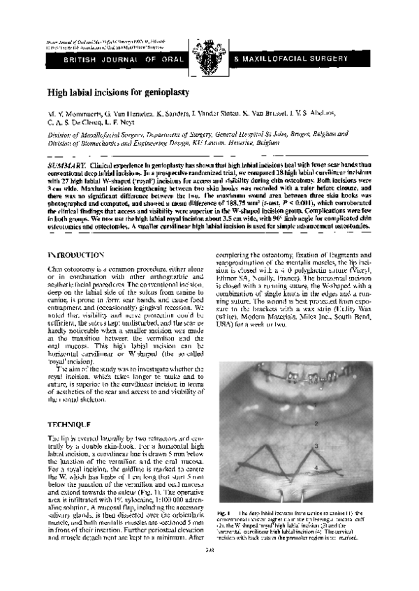 (PDF) High labial incisions for genioplasty