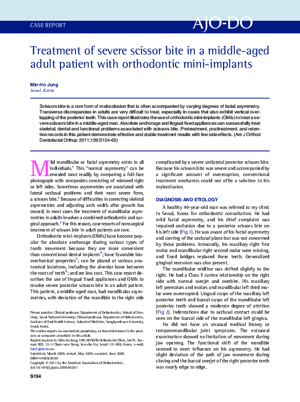 (PDF) Treatment of severe scissor bite in a middle-aged adult patient ...