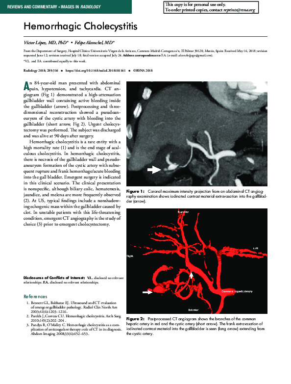 (PDF) Hemorrhagic Cholecystitis