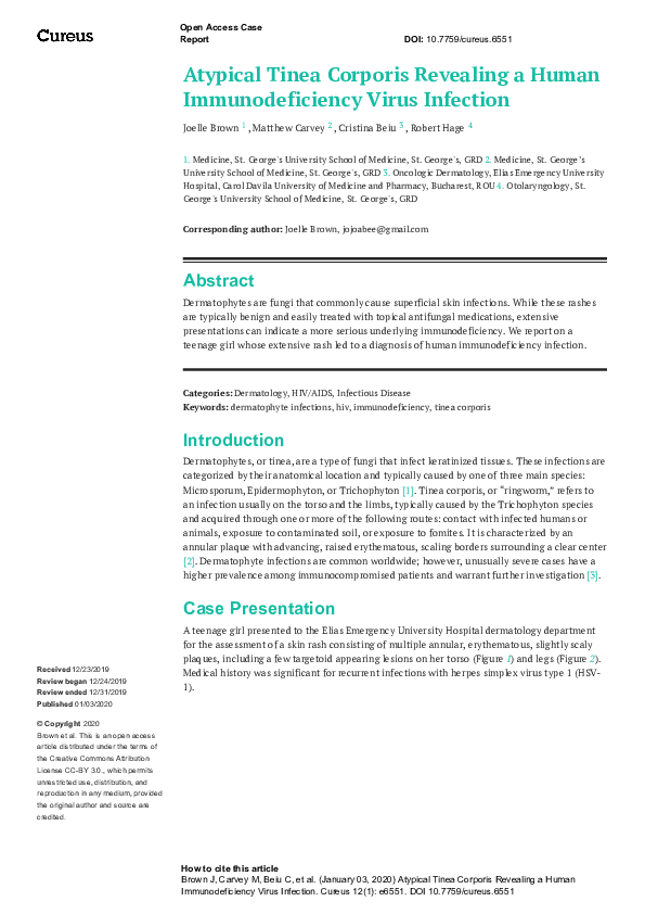 (PDF) Atypical Tinea Corporis Revealing a Human Immunodeficiency Virus ...