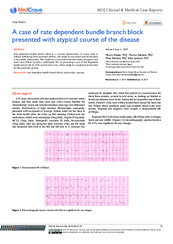(PDF) A case of rate dependent bundle branch block presented with ...