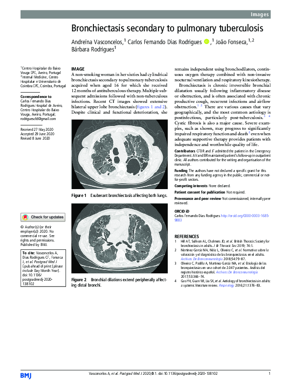 (PDF) Bronchiectasis secondary to pulmonary tuberculosis | Andreina ...