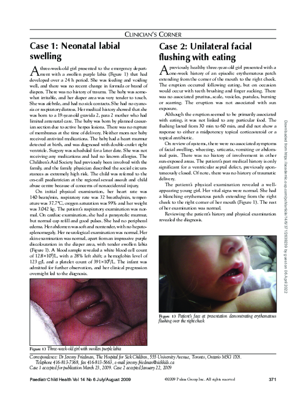 (PDF) Case 2: Unilateral facial flushing with eating