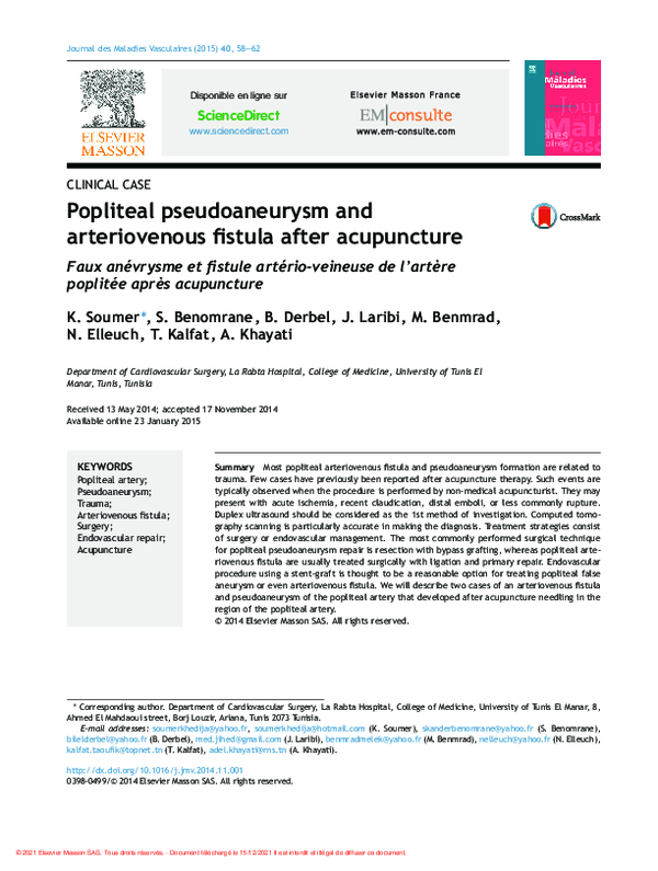 (PDF) Popliteal pseudoaneurysm and arteriovenous fistula after acupuncture