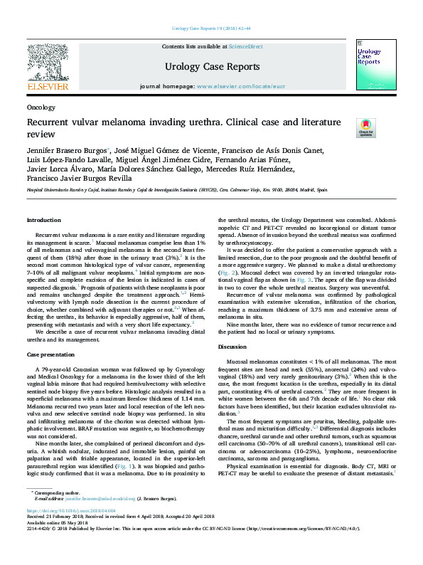 (PDF) Recurrent vulvar melanoma invading urethra. Clinical case and literature review