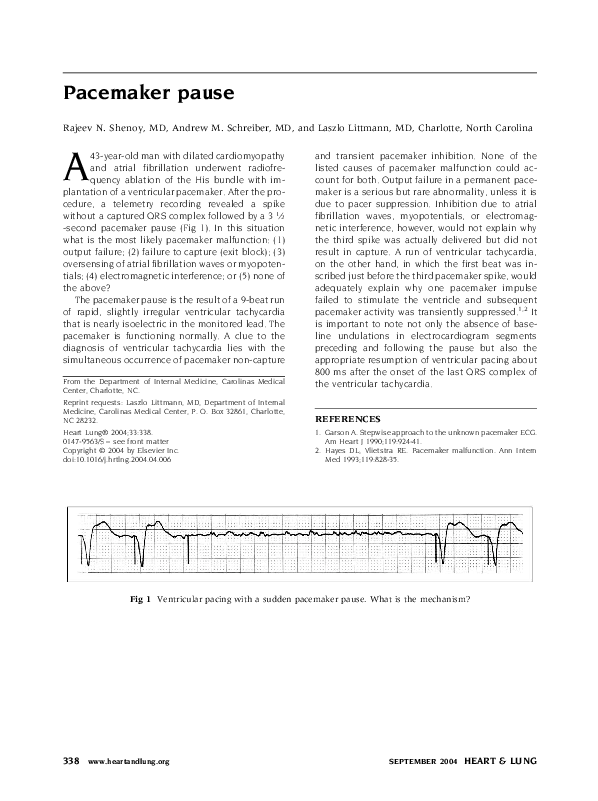(PDF) Pacemaker pause