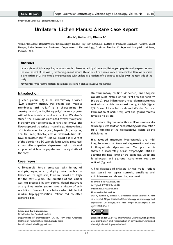 (PDF) Unilateral Lichen Planus: A Rare Case Report