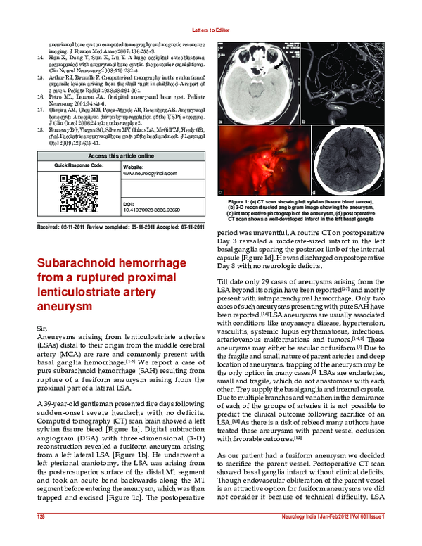 (PDF) Subarachnoid hemorrhage from a ruptured proximal lenticulostriate artery aneurysm