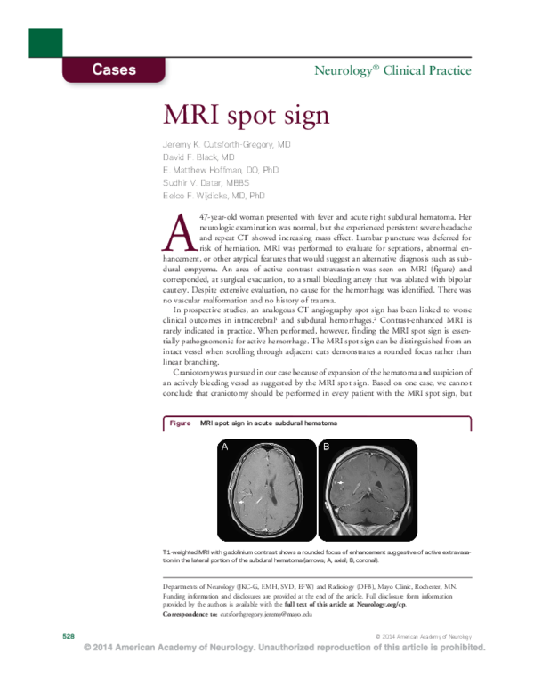 (PDF) MRI spot sign