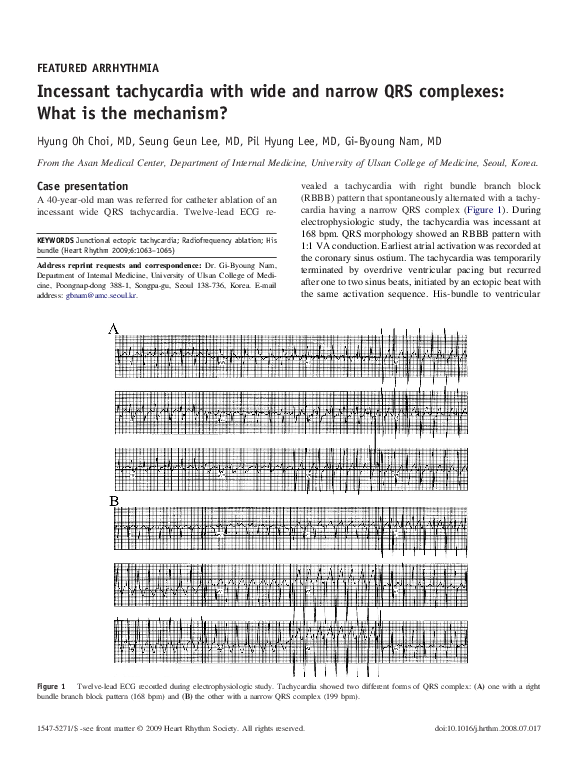 (PDF) Incessant tachycardia with wide and narrow QRS complexes: What is ...