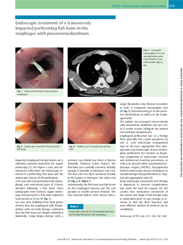 (PDF) Endoscopic treatment of a transversely impacted perforating fish ...