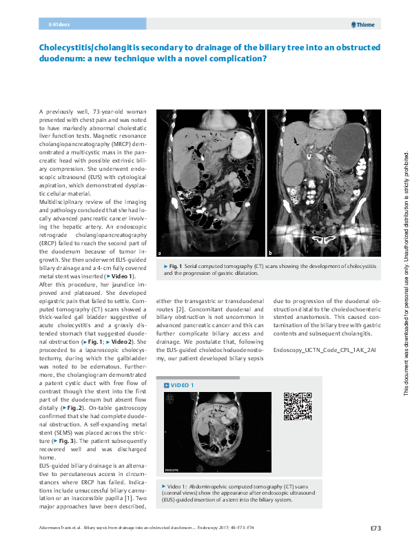 (PDF) Cholecystitis/cholangitis secondary to drainage of the biliary ...
