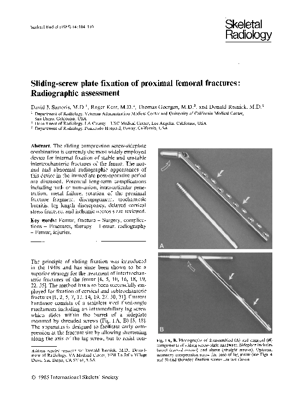 (PDF) Sliding-screw plate fixation of proximal femoral fractures ...