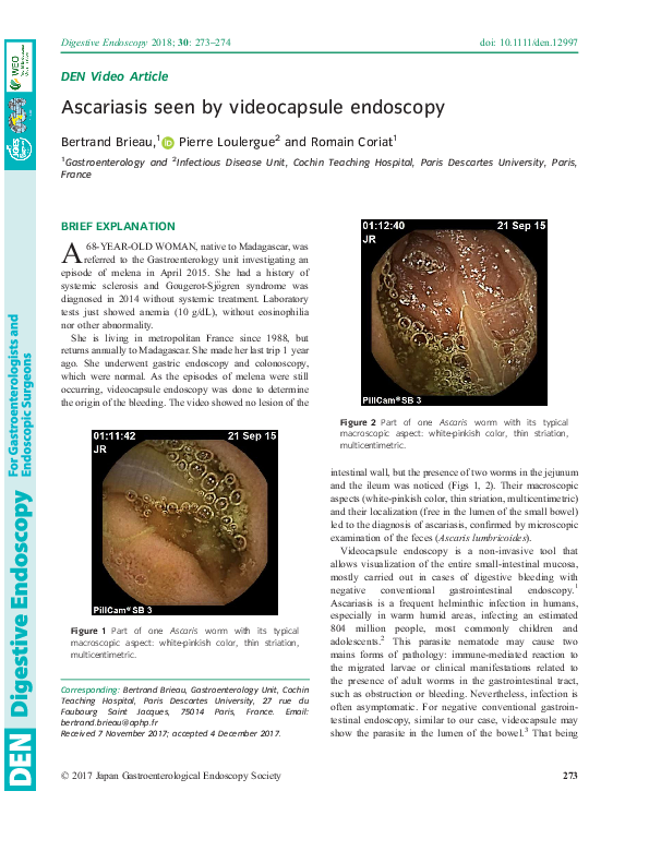 (PDF) Ascariasis seen by videocapsule endoscopy | Pierre Loulergue - Academia.edu