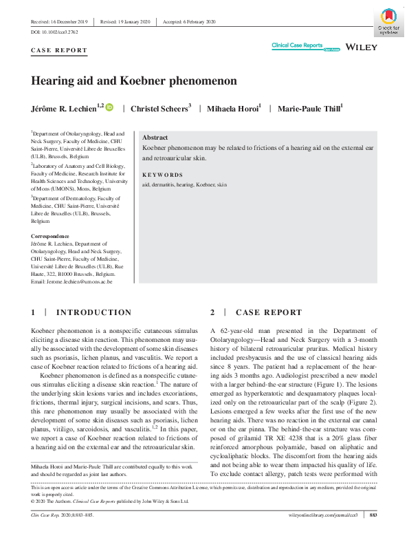 (PDF) Hearing aid and Koebner phenomenon | christel scheers - Academia.edu