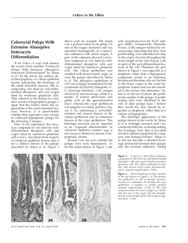 (PDF) Colorectal Polyps With Extensive Absorptive Enterocyte ...