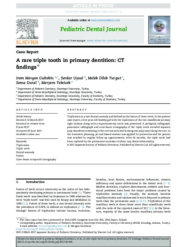(PDF) A rare triple tooth in primary dentition: CT findings