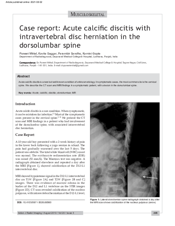 (PDF) Case report: Acute calcific discitis with intravertebral disc ...