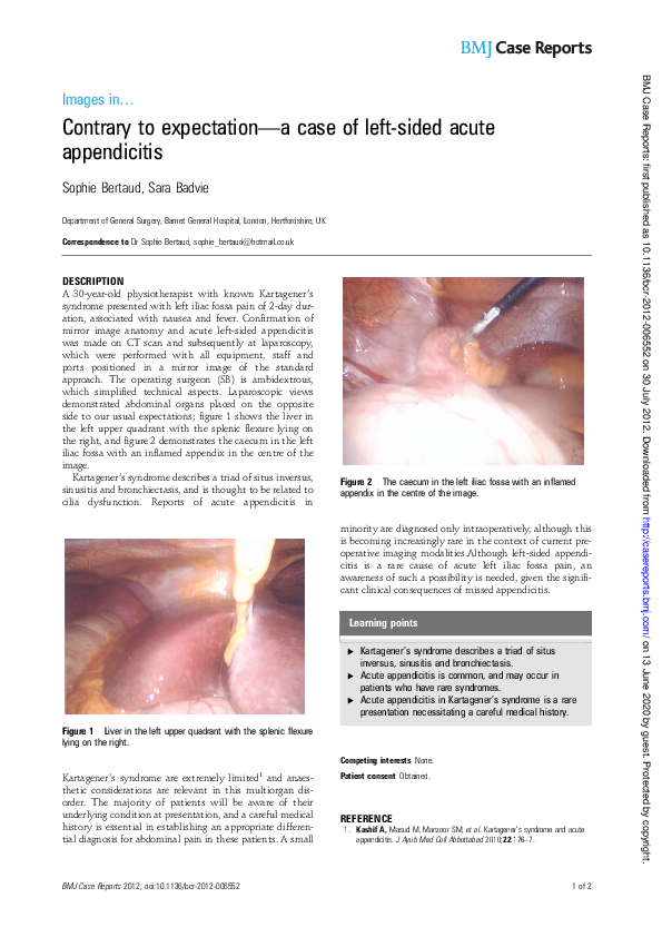 (PDF) Contrary to expectation--a case of left-sided acute appendicitis