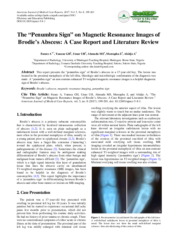 (PDF) The “Penumbra Sign” on Magnetic Resonance Images of Brodie’s ...