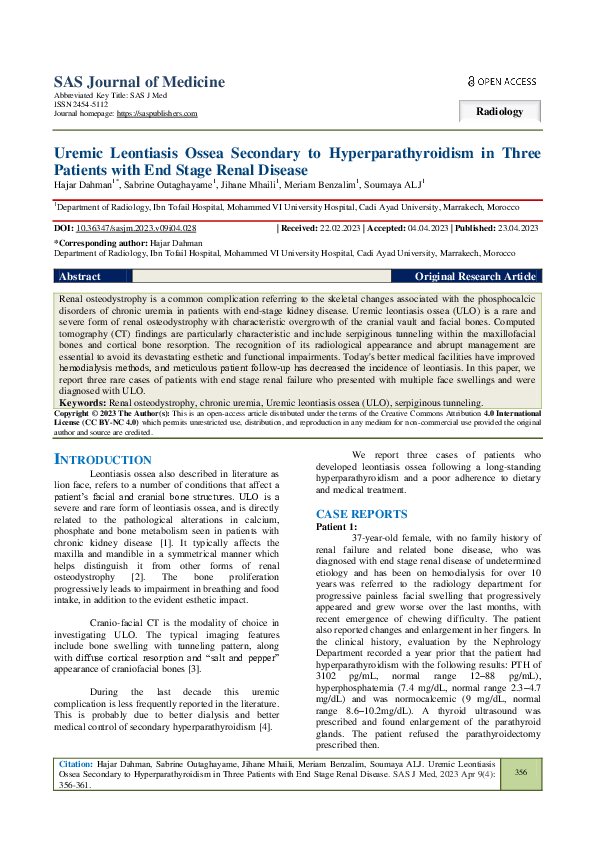 (PDF) Uremic Leontiasis Ossea Secondary to Hyperparathyroidism in Three ...