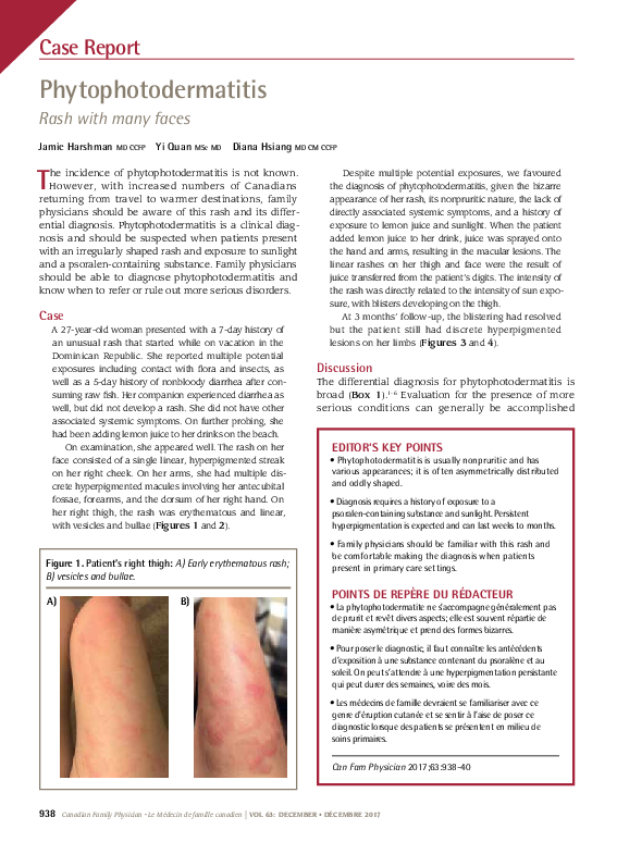 (PDF) Case Report Phytophotodermatitis Rash with many faces