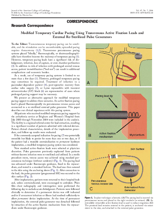 (PDF) Modified Temporary Cardiac Pacing Using Transvenous Active ...