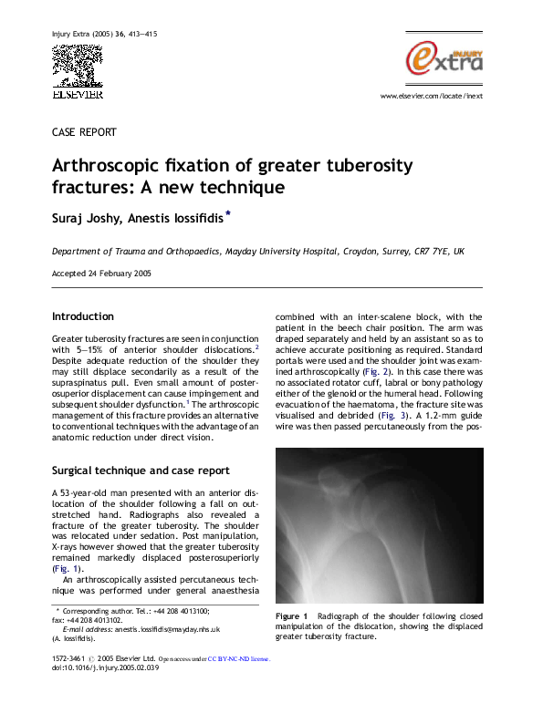 (PDF) Arthroscopic fixation of greater tuberosity fractures: A new ...