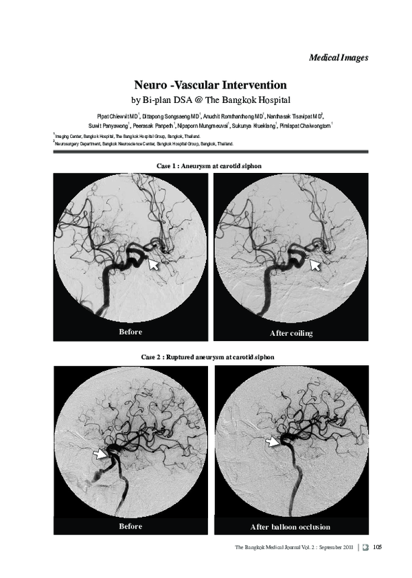 (PDF) Neuro -Vascular Intervention