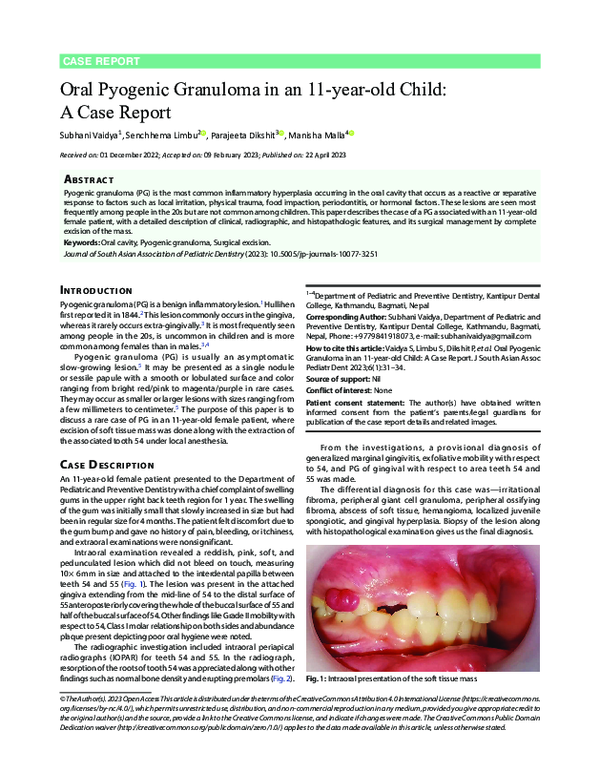 (PDF) Oral Pyogenic Granuloma in an 11-year-old Child: A Case Report