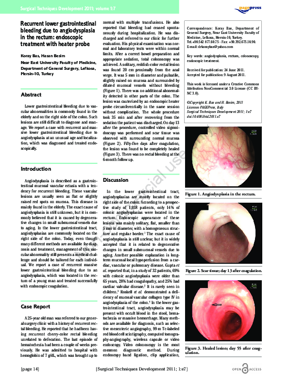 (PDF) Recurrent lower gastrointestinal bleeding due to angiodysplasia ...