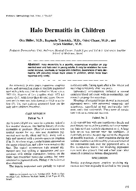 (PDF) Halo Dermatitis in Children