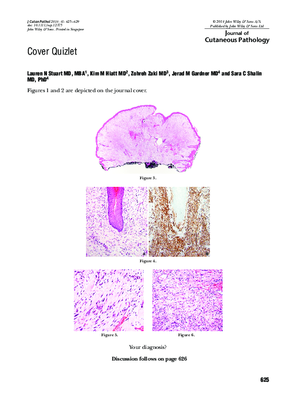 (PDF) Plaque-like CD34-positive Dermal Fibroma (“Medallion-like Dermal ...