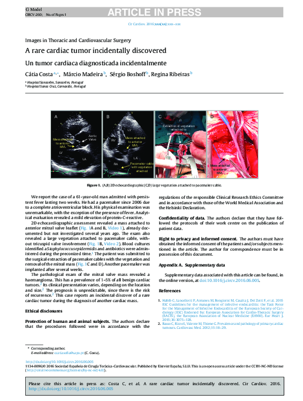 (PDF) A rare cardiac tumor incidentally discovered