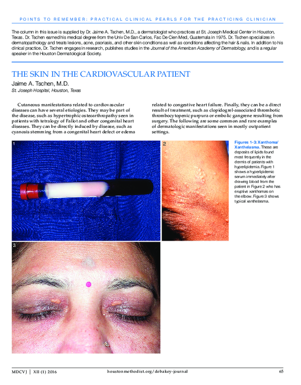 (PDF) Points To Remember: The Skin in the Cardiovascular Patient