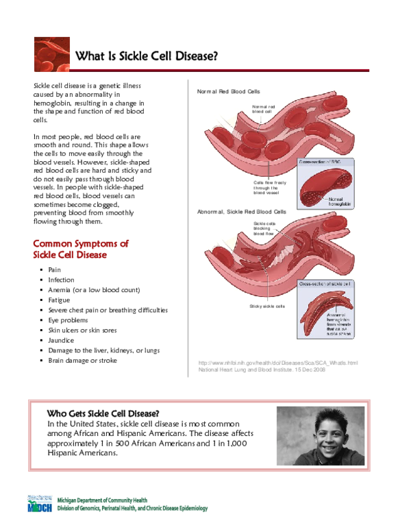 (PDF) Sickle cell disease